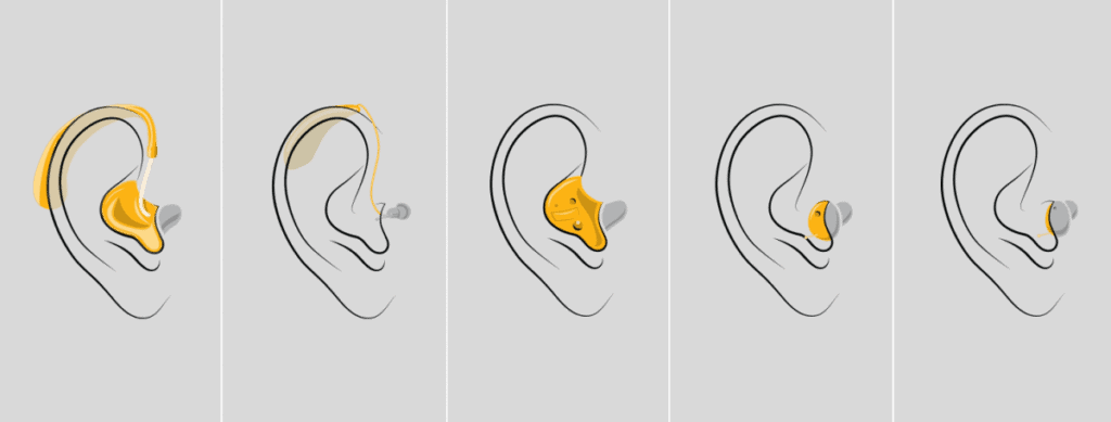 Hearing Aids - American Academy of Audiology