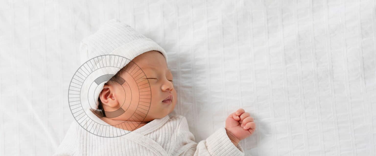 The American Academy of Audiology