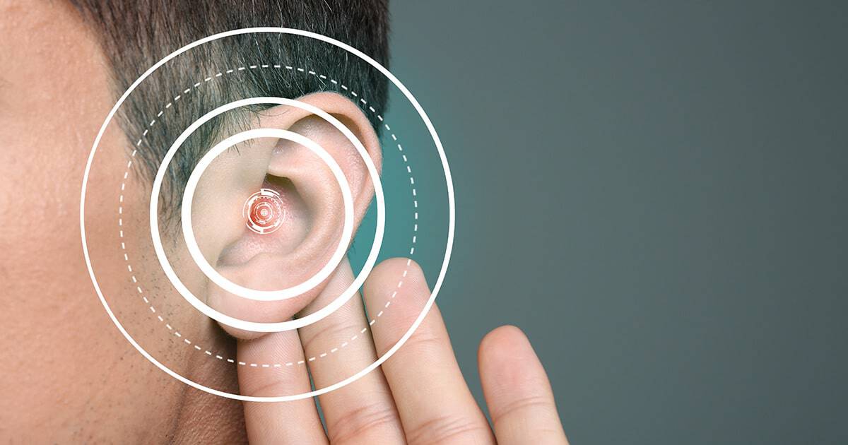 How Do You Solve a Problem Like Single Sided Deafness? - American ...